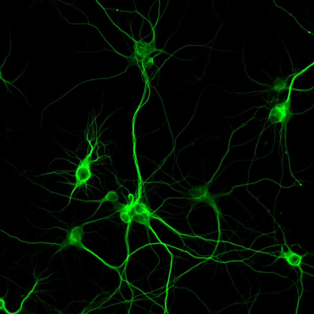 Primary neuron from a rat cortex - supplied by Transnetyx Tissue by ...